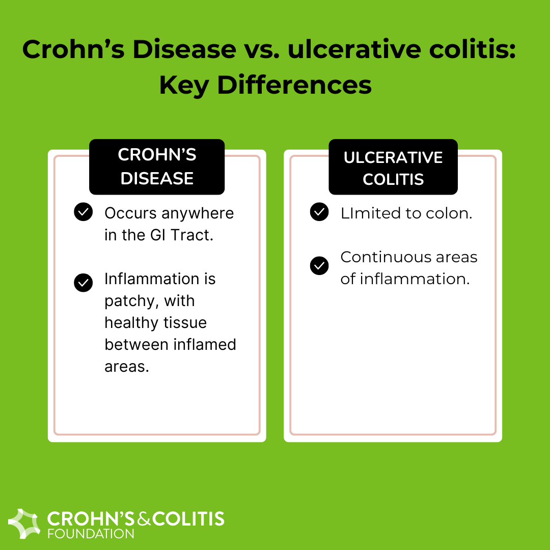 Crohn's vs. Colitis: Early Signs, Differences, and Diagnosis