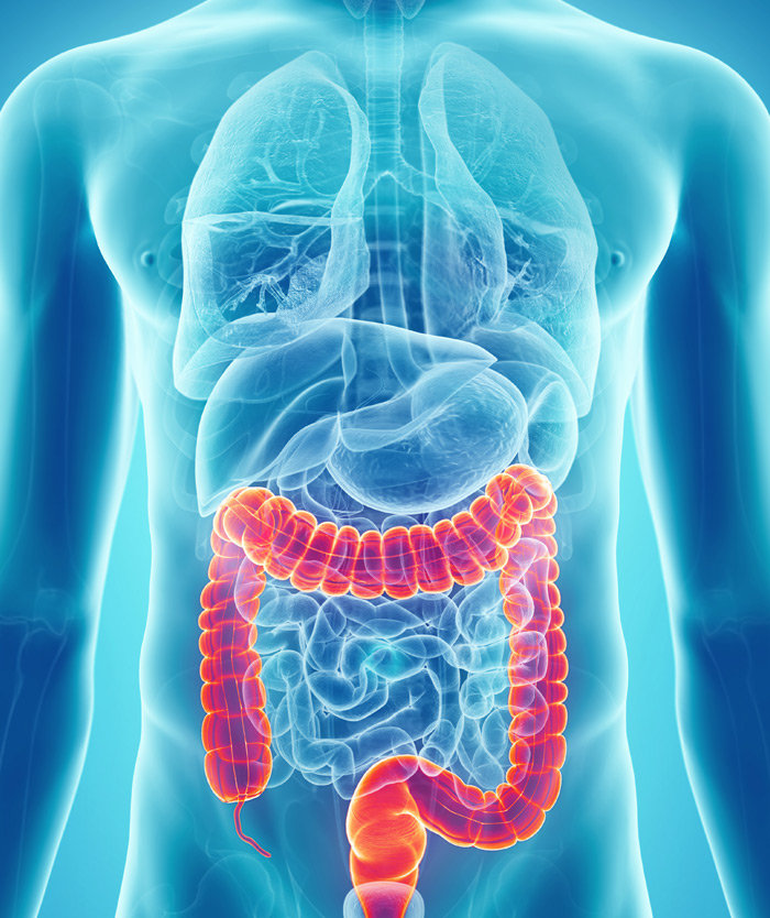 Crohn’s & Colitis Foundation and Evotec Enter Agreement to Advance Drug ...
